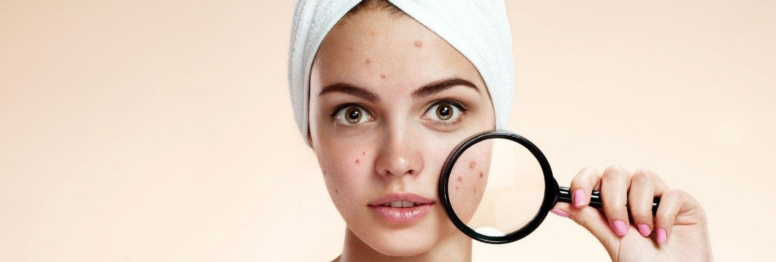 11 Answers to Acne Questions You've Always Wanted to Ask – Dr. Lin Skincare